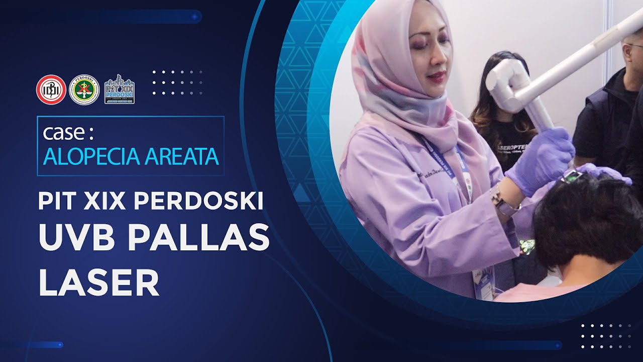 PIT XIX Perdoski Jakarta 2023 PALLAS LASER FOR ALOPECIA with dr. Antoni ...