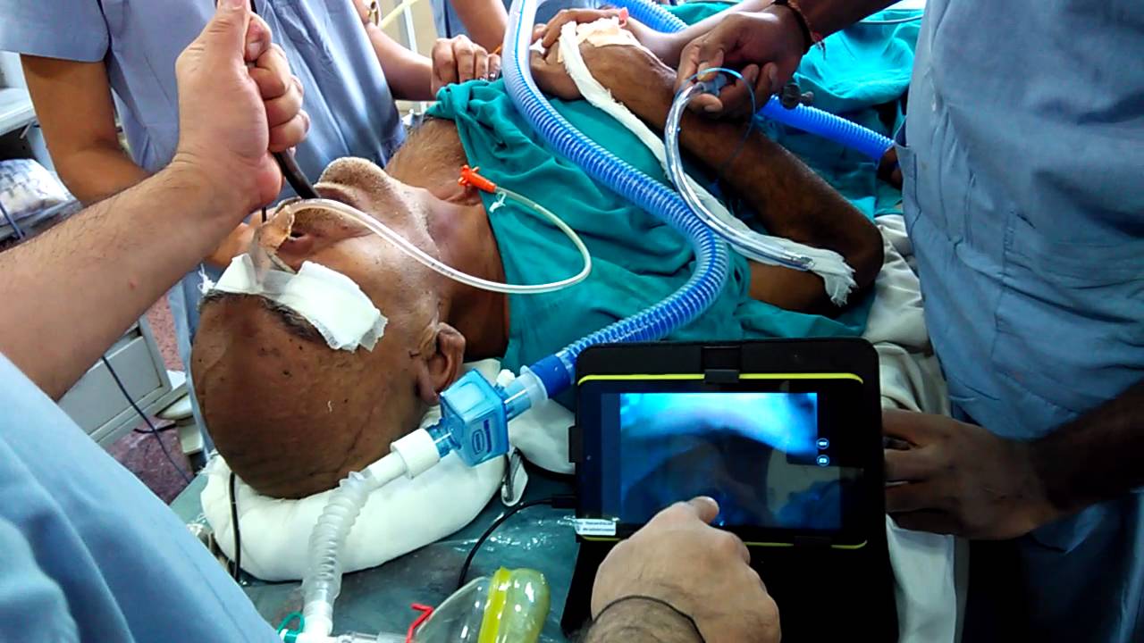 Difficult Intubation Made Easy With Video Laryngoscope : our own design ...