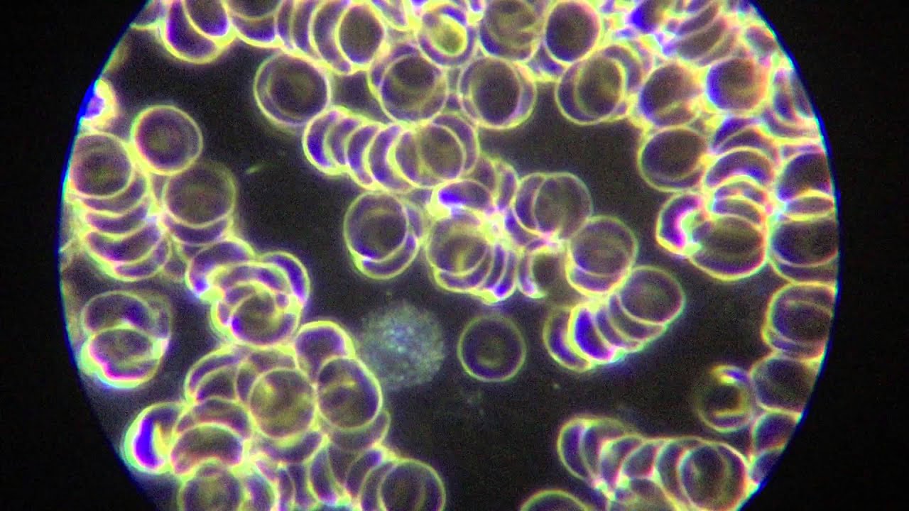 Australian Lyme Spirochete Bacteria - Dark Field 3 - April 2015 - YouTube