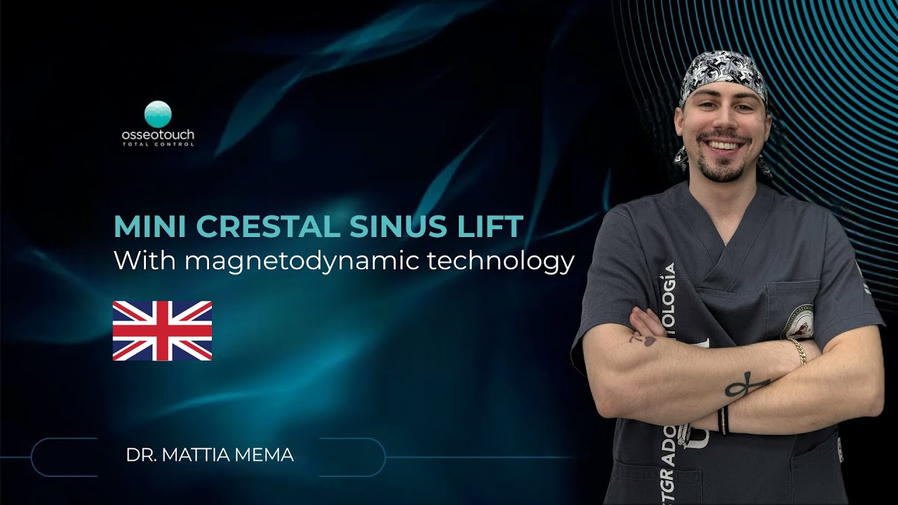 Sinus lift Crestal approach drill-free with magnetic mallet - YouTube
