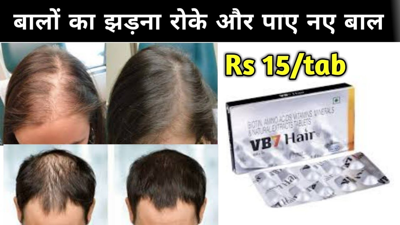 VB7 Hair Tablet Review| Best Hairfall Control supplement|Intas| Uses ...
