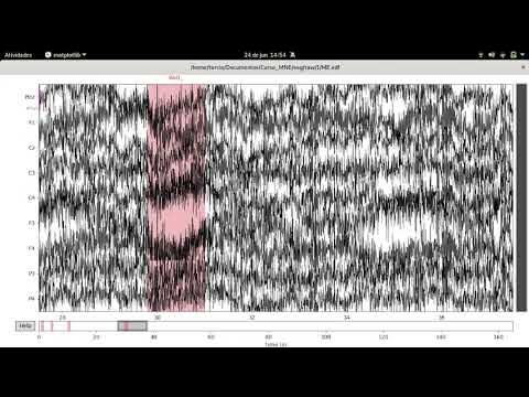 Workshop de processamento de sinais de EEG utilizando MNE-Python ...