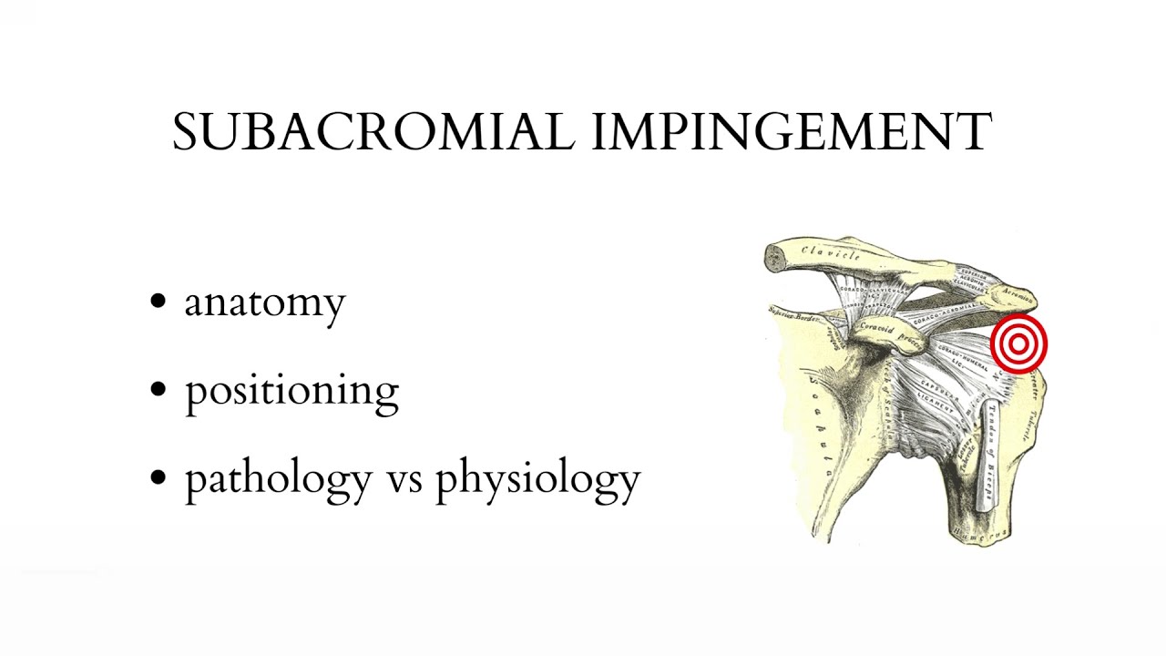 SUBACROMIAL IMPINGEMENT - musculoskeletal ultrasound examination - YouTube