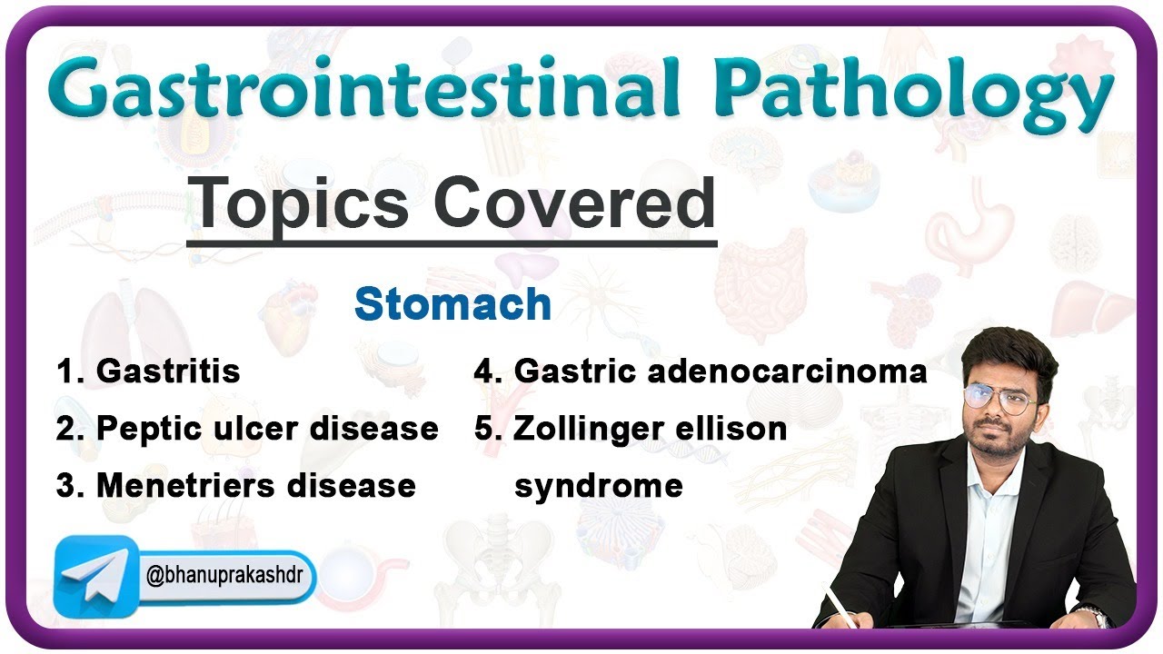 Gastrointestinal pathology - Disorders of Stomach - YouTube