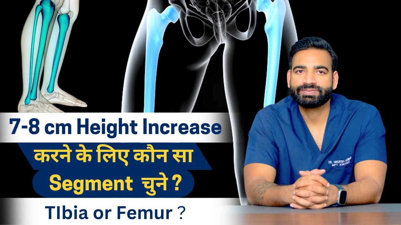 7-8 cm Height Increase करने के लिए कौन सा Segment चुने ? TIbia or Femur ...