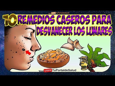 Como Quitar Lunares | 10 Remedios Caseros Para Desvanecer los Lunares ...