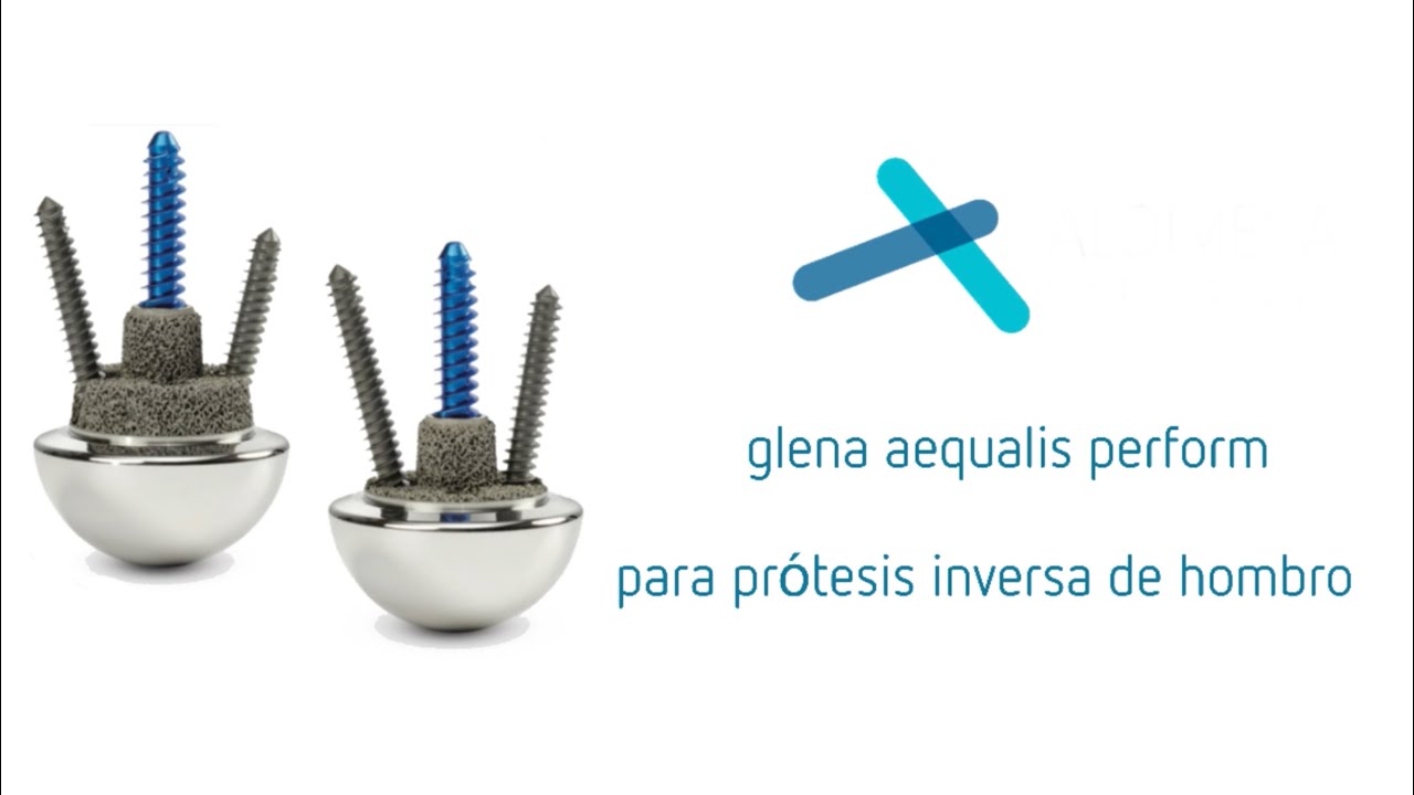 Aldimesa - Glena Aequalis Perform Reversed - YouTube