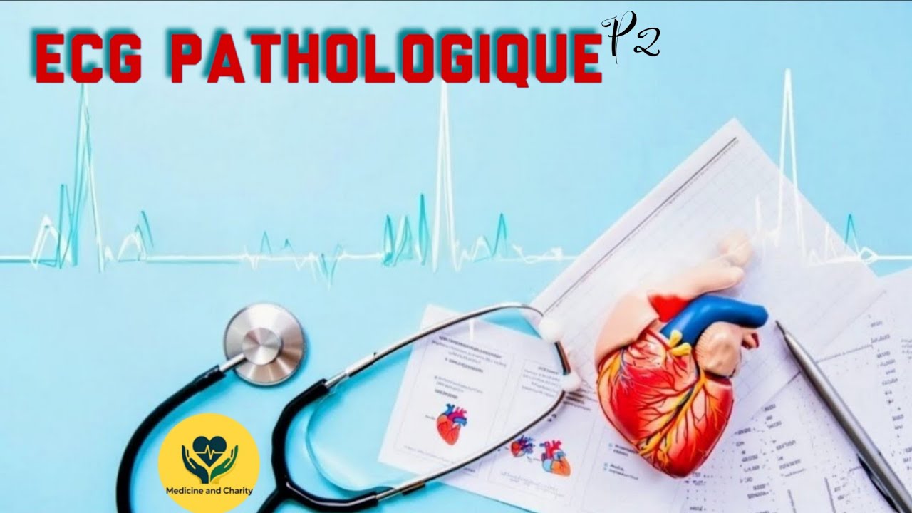 📚 sémiologie 3ème année Médecine 🔸️ ECG pathologique 🫀partie 02📌 - YouTube