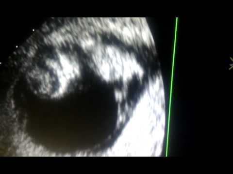 10 Weeks Pregnant Scan - BabysFirstCalendar.co.uk Pregnancy Diary week ...