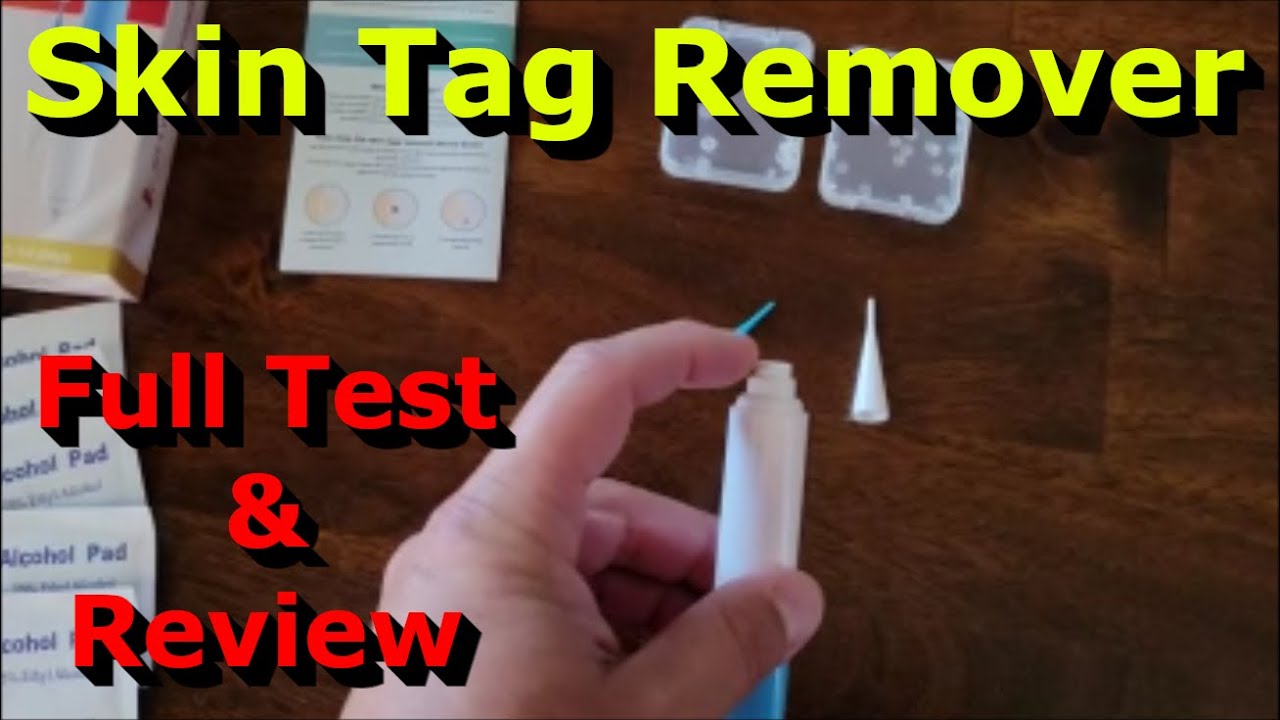 Skin Tag Remover - Auto Skin Tag Remover Pen - YouTube