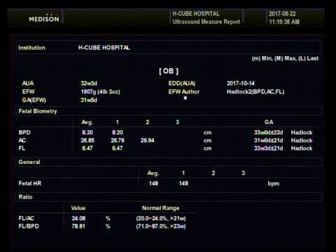 8 months Pregnant(2)