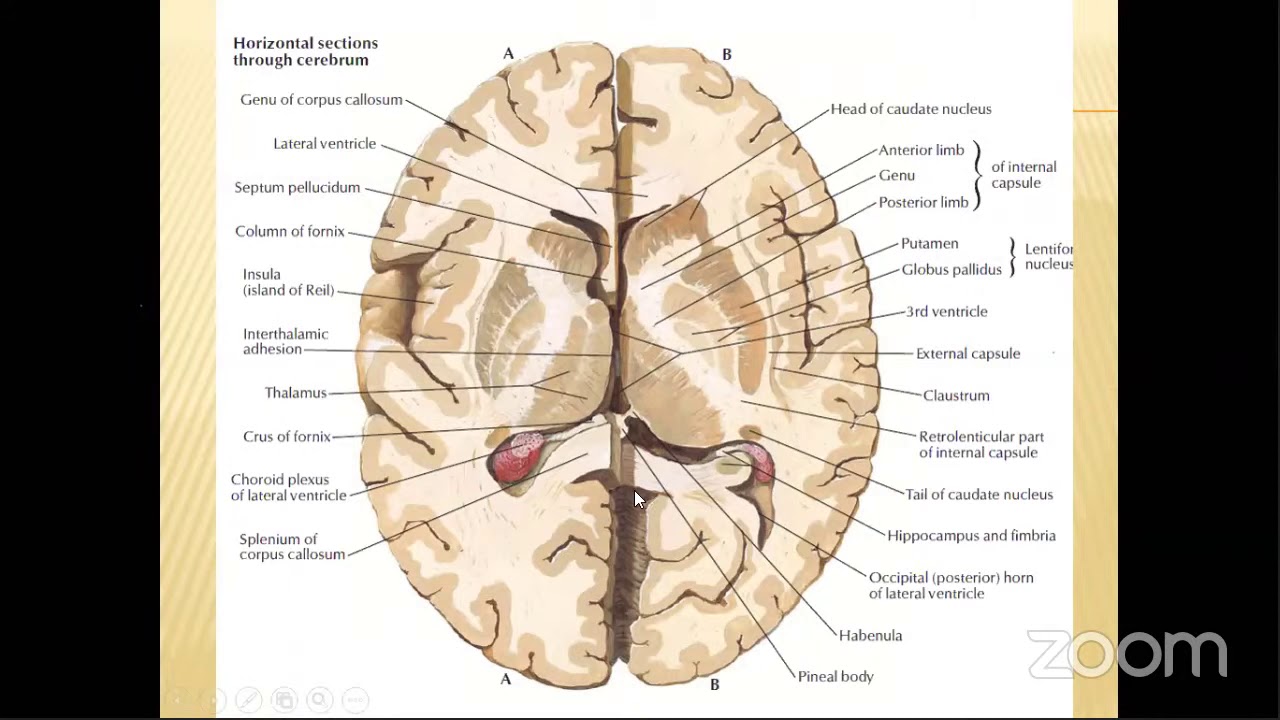 Lectura e Interpretación de TAC Cerebral / NEUROANATOMÍA BÁSICA - YouTube