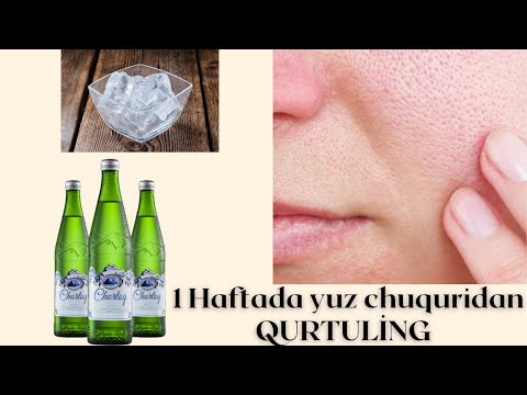 1Haftada yuzdagi chuqurlarni yuqotish Yuzdagi poralardan qurtilish #makeuptutorial