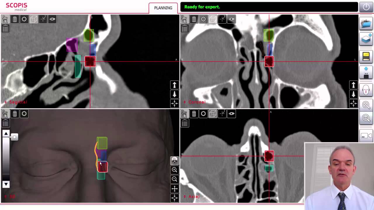 Scopis Building Blocks Planning Tutorial - YouTube
