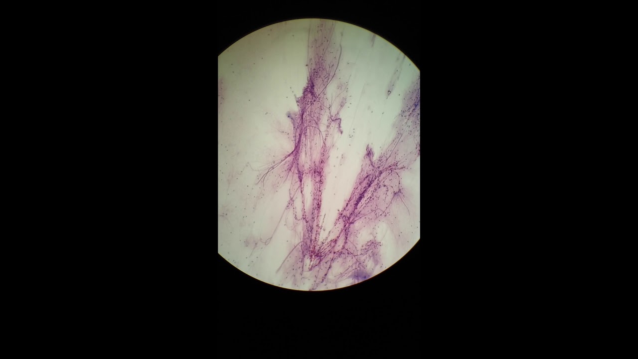 "OX Spinal cord; motor nerve cells, smr. HE 4-1" (TRIARCH) via Nikon ...