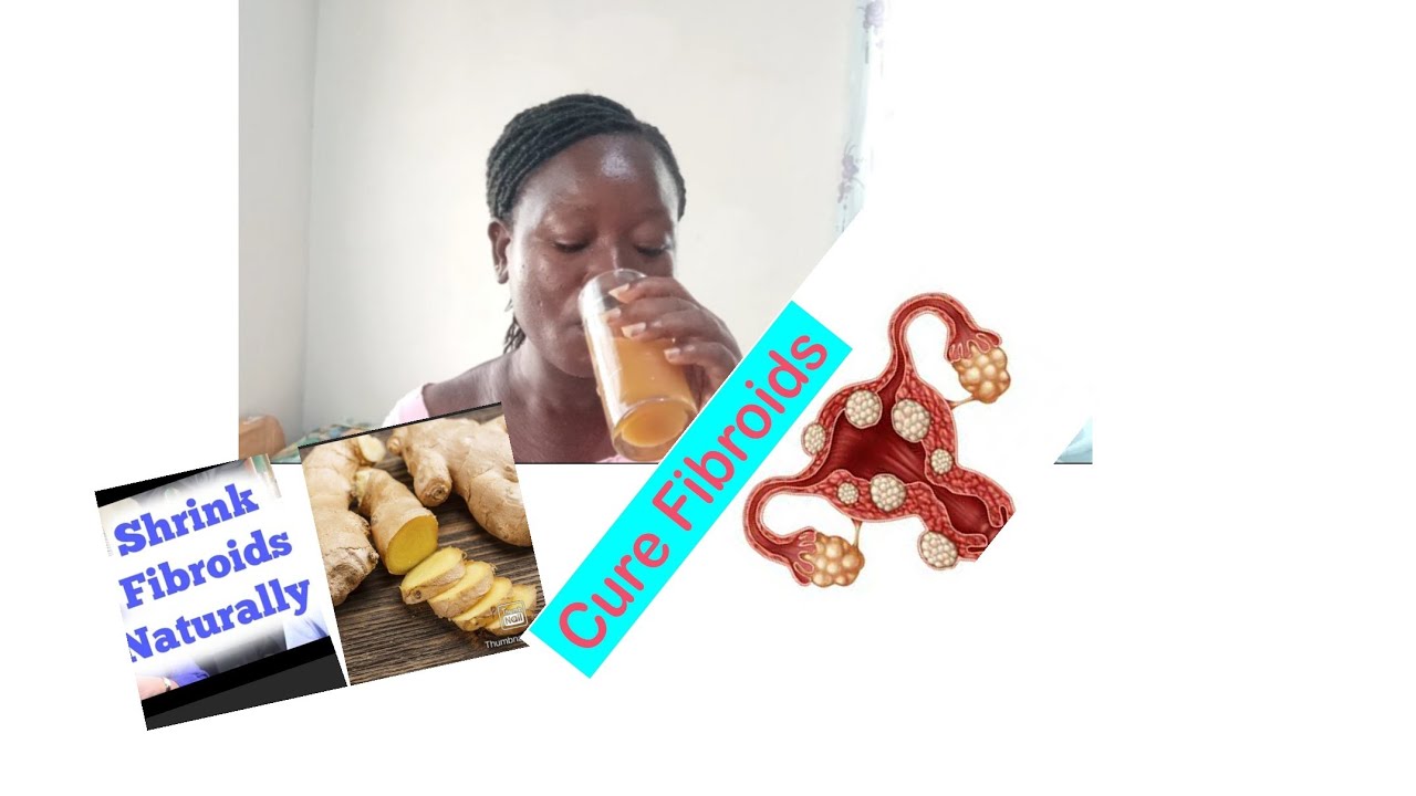 DIY..HOW TO GET RID OF FIBROIDS NATURALLY WITHOUT SURGERY..USING JUST ...