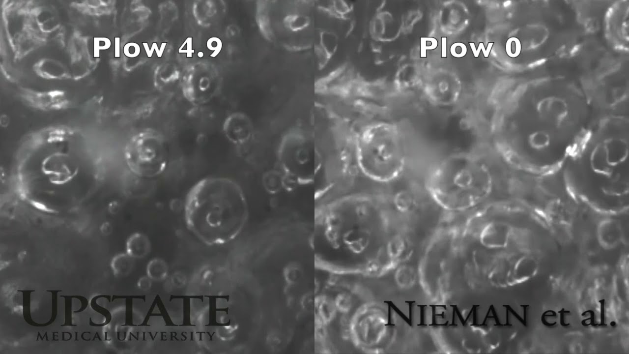 C-PEEP and TC-PEEP - YouTube