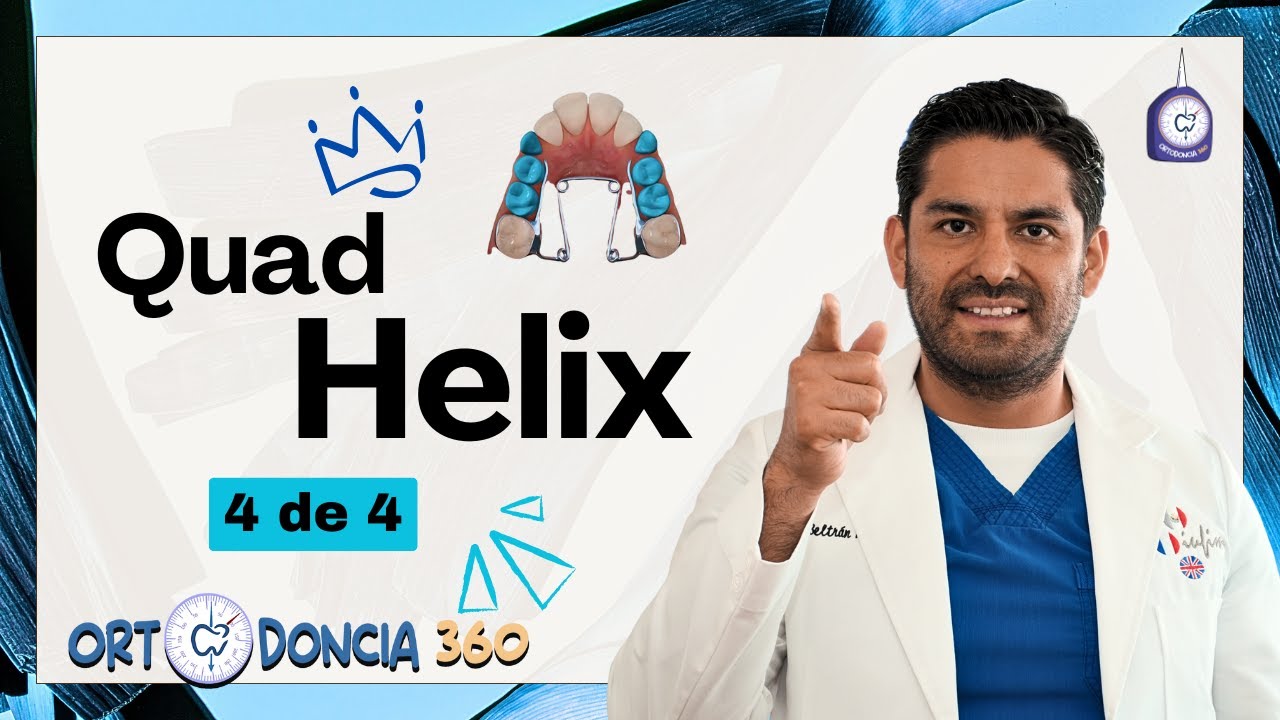 Quad Helix 4 de 4 - YouTube