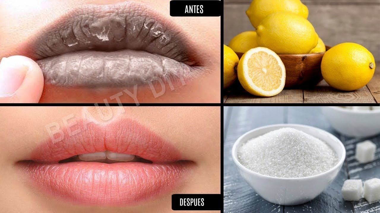 COMO ACLARAR Y ELIMINAR LA RESEQUEDA DE LOS LABIOS - YouTube