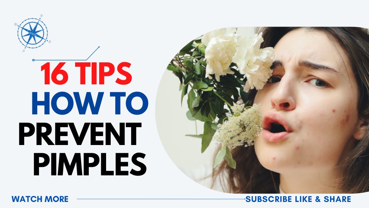 How to prevent Pimples PIMPLES | ACNE TREATMENT | How To Remove Pimples ...