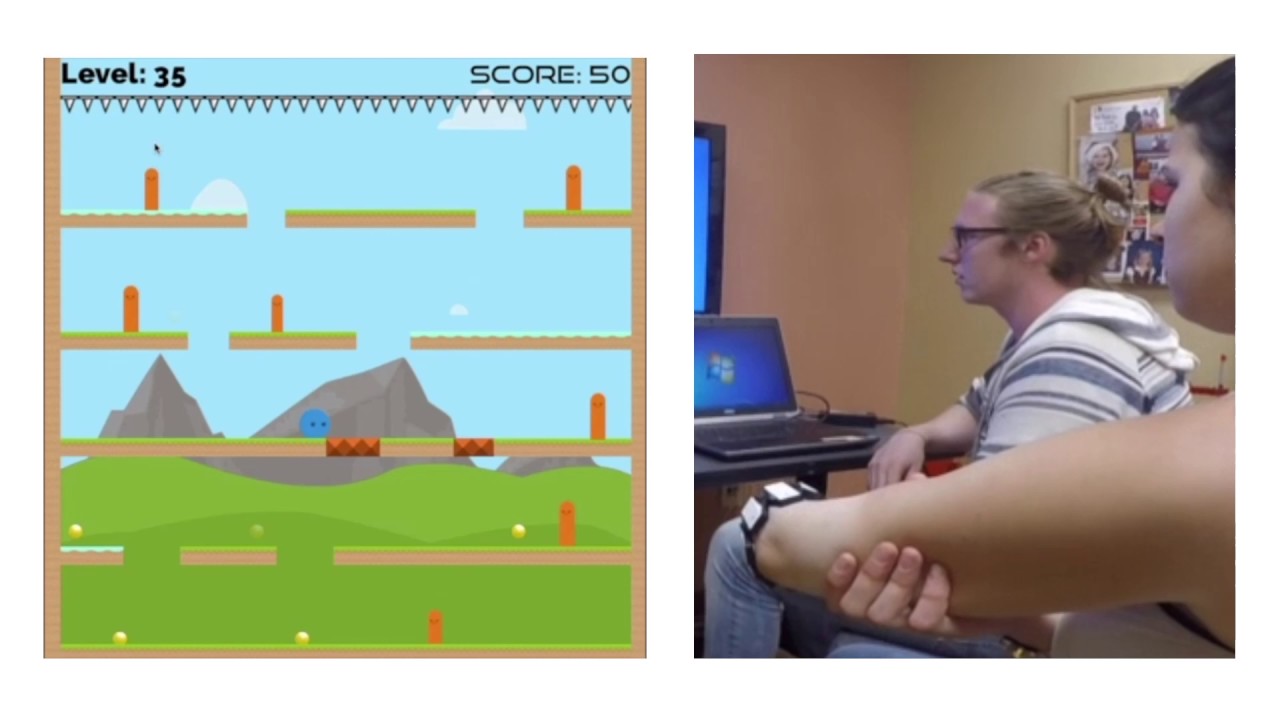 Video Preview of Designing Game-Based Myoelectric Prosthesis Training ...