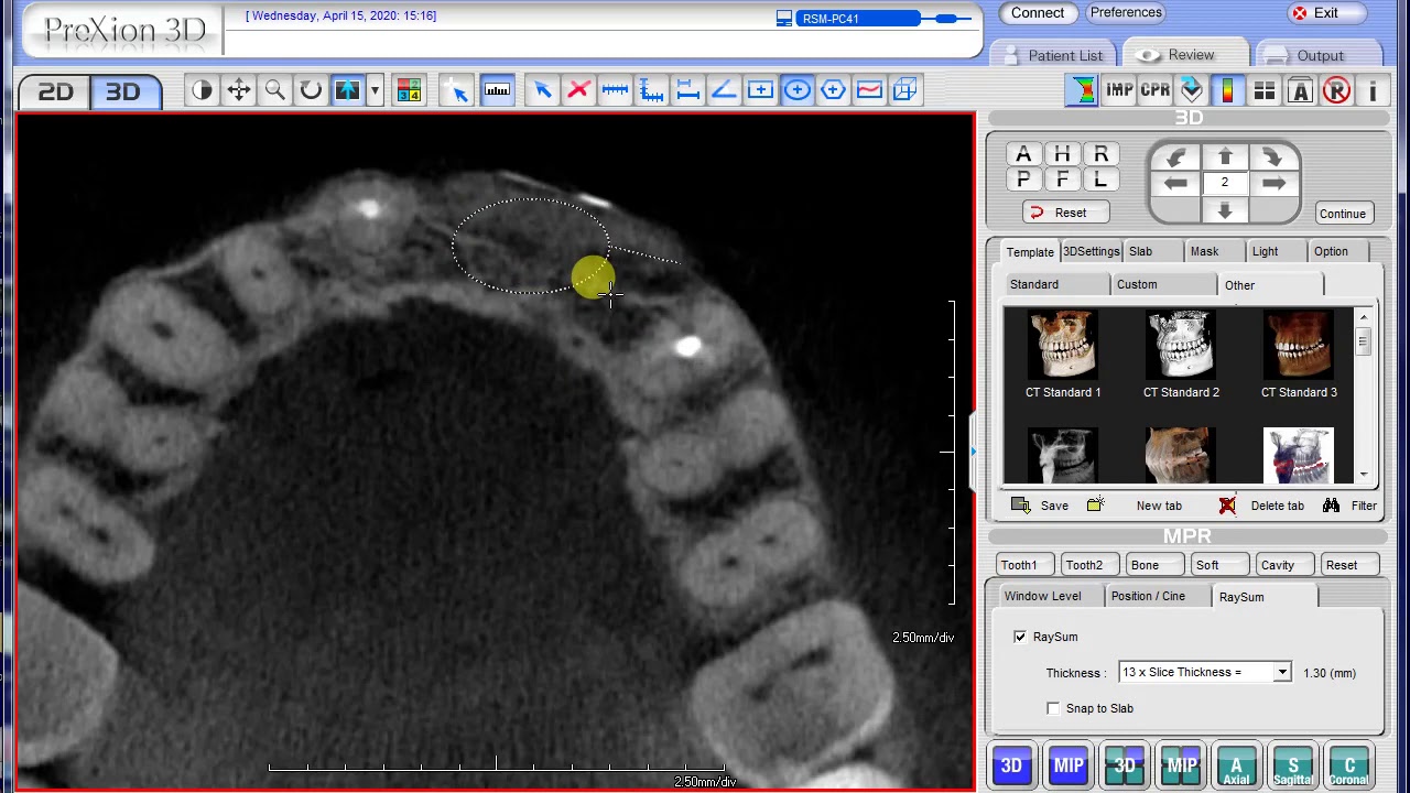 PreXion Training Tips: Measurement Toolbar Functions - YouTube