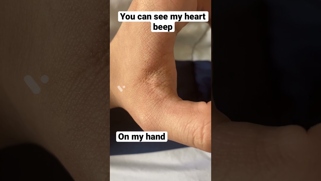 You can see your heart beep on your hand - YouTube