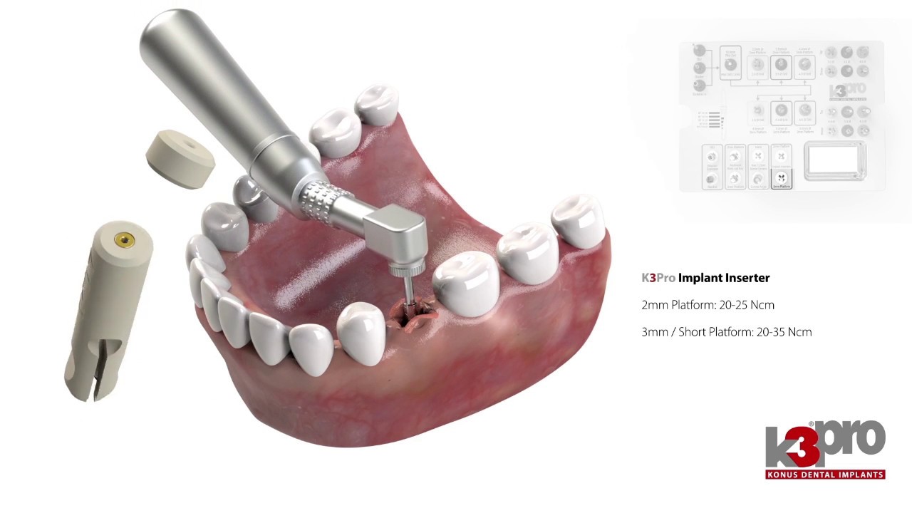 K3Pro Rapid Surgical Kit Overview - YouTube