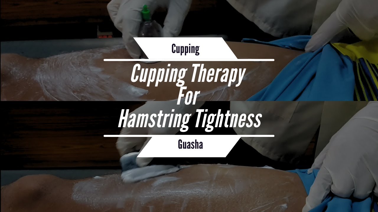 Cupping/ Guasha Therapy For Hamstring Tightness - YouTube