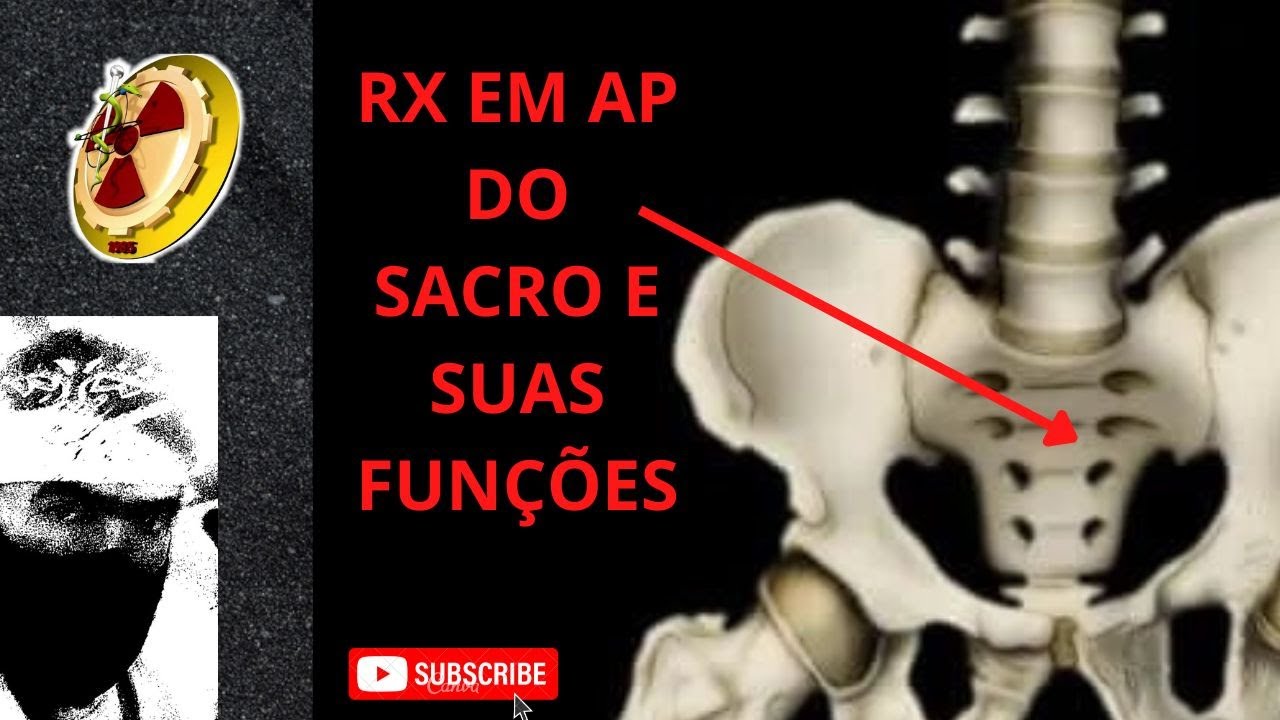 Rx do Sacro e suas funções. - YouTube