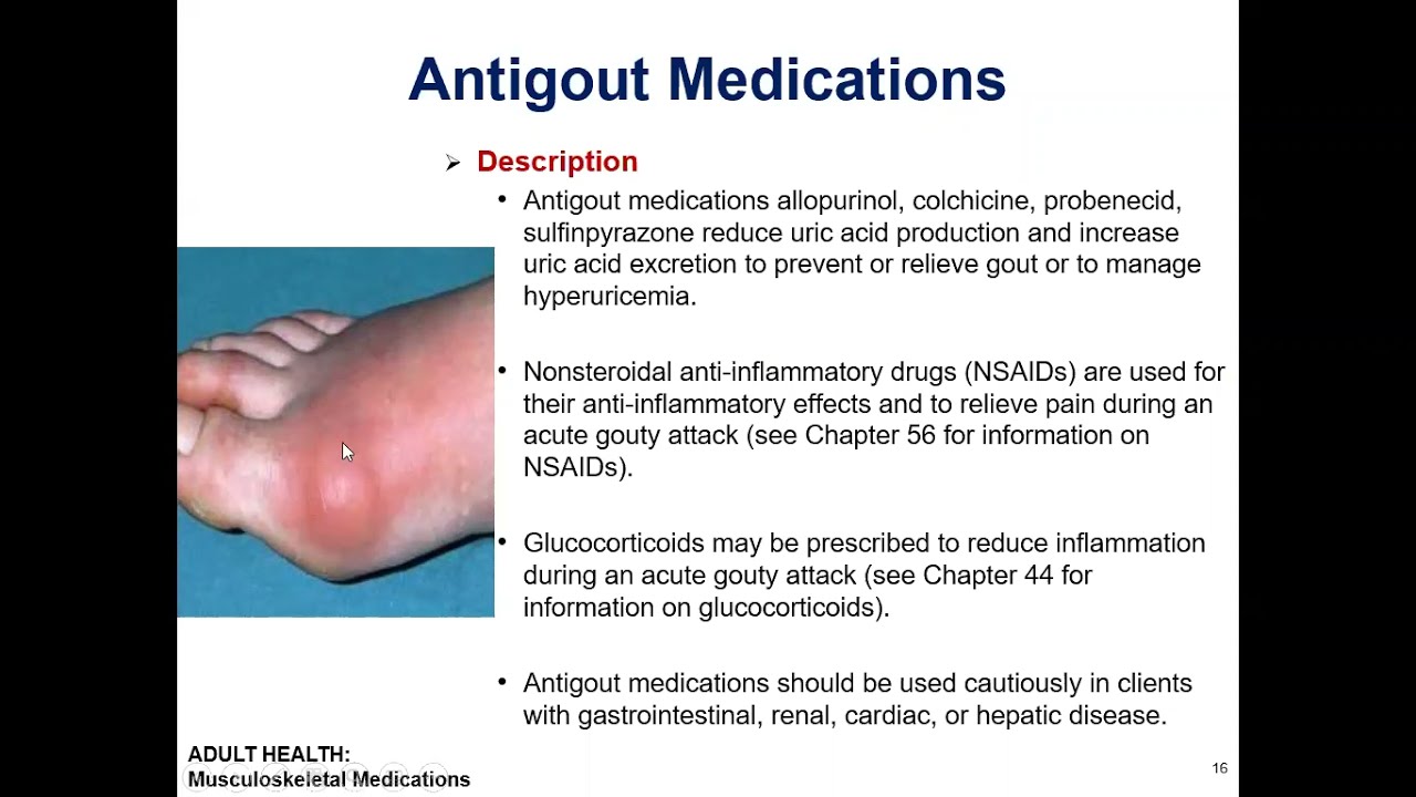 Musculoskeletal Medication part 2 skeletal muscle relaxants - YouTube