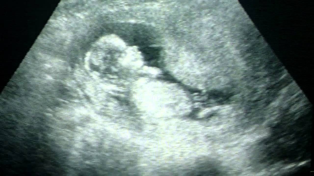 14 semanas de embarazo muy feliz con mi bebe - YouTube