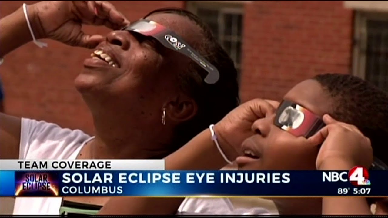 NBC4: Solar Eclipse and Eye Damage - YouTube