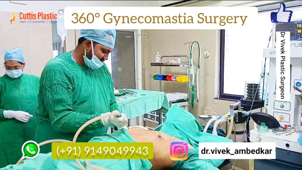 360° Gynecomastia Surgery | Liposuction | Chest Fat Transformation ...