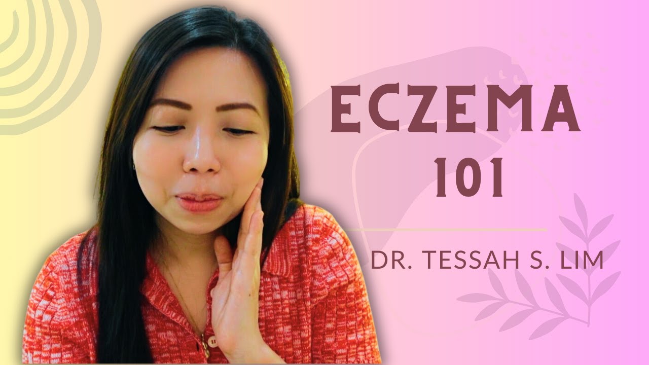 ECZEMA 101 (Atopic Dermatitis, Seborrheic Dermatitis, Nummular eczema ...
