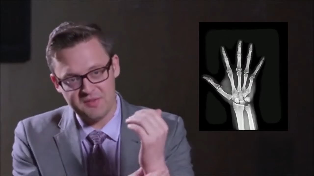 Dynamic Digital Radiography in Orthopedics | Konica Minolta Healthcare ...