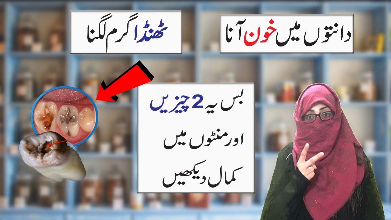 Gums Disease / Pyria & Cavity Treatment at home | Anam Home Remedy ...