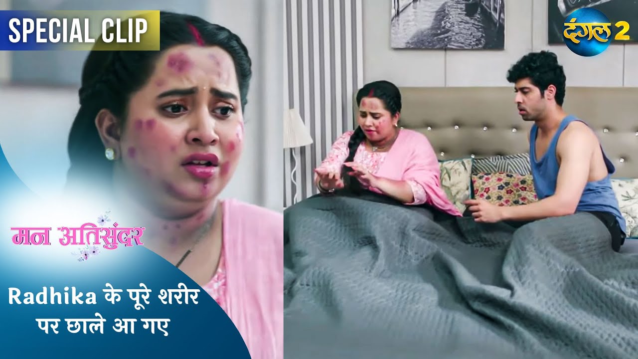 Mann Ati Sundar | Radhika के पूरे शरीर पर छाले आ गए | Dangal TV Special ...