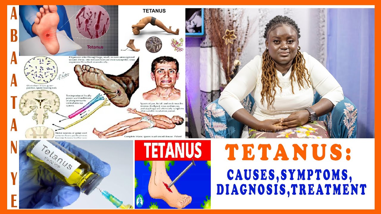TETANUS : CAUSES , SYMPTOMS , DIAGNOSIS , TREATMENT - YouTube