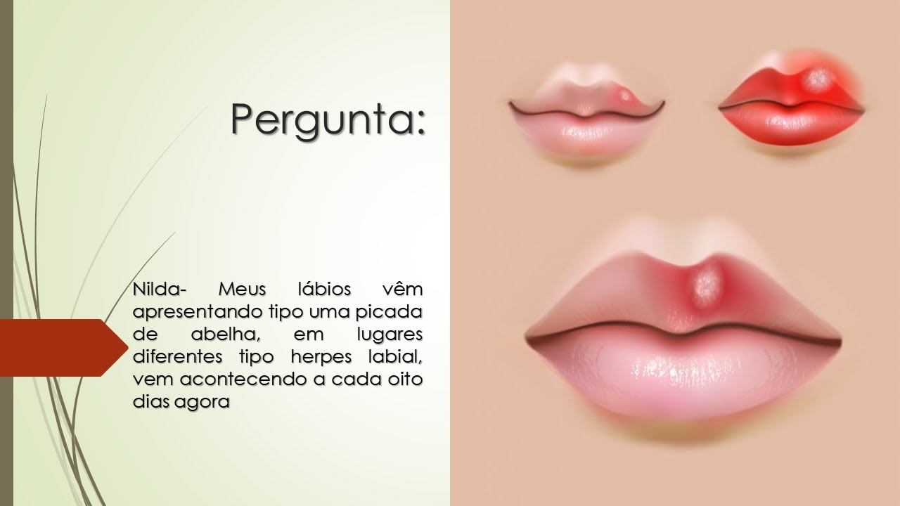 Meus lábios vêm apresentando uns pontos em lugares diferentes | Parece ...