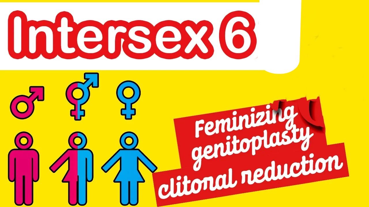 Ep 6 - Intersex - Feminizing genitoplasty clitoral reduction - Khaled ...