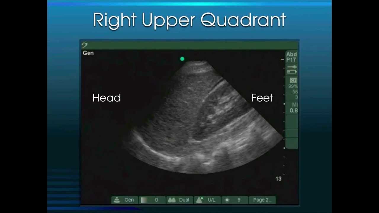 2 FAST exam - YouTube