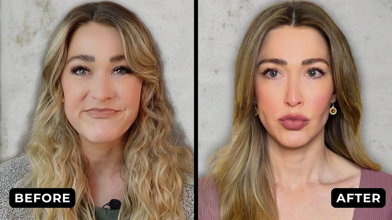 How I Transformed My Face (Before & After) - YouTube