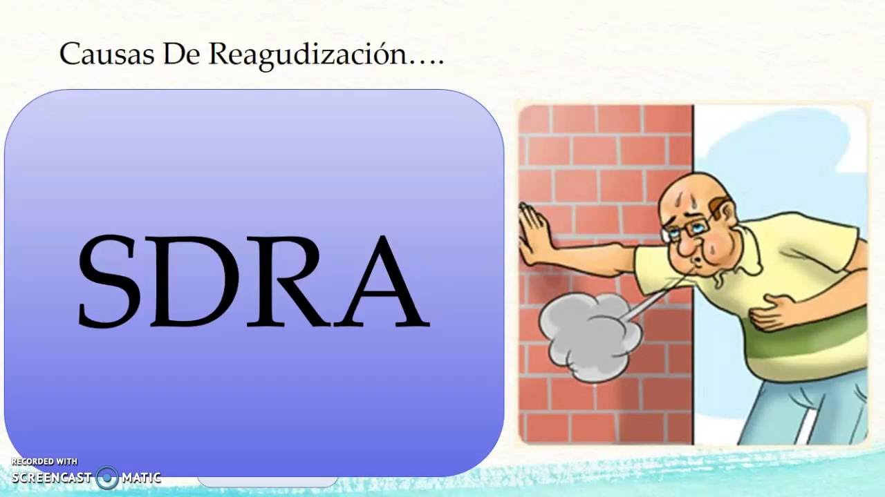 Manejo del paciente con SDRA (Antecedente Epoc) - YouTube