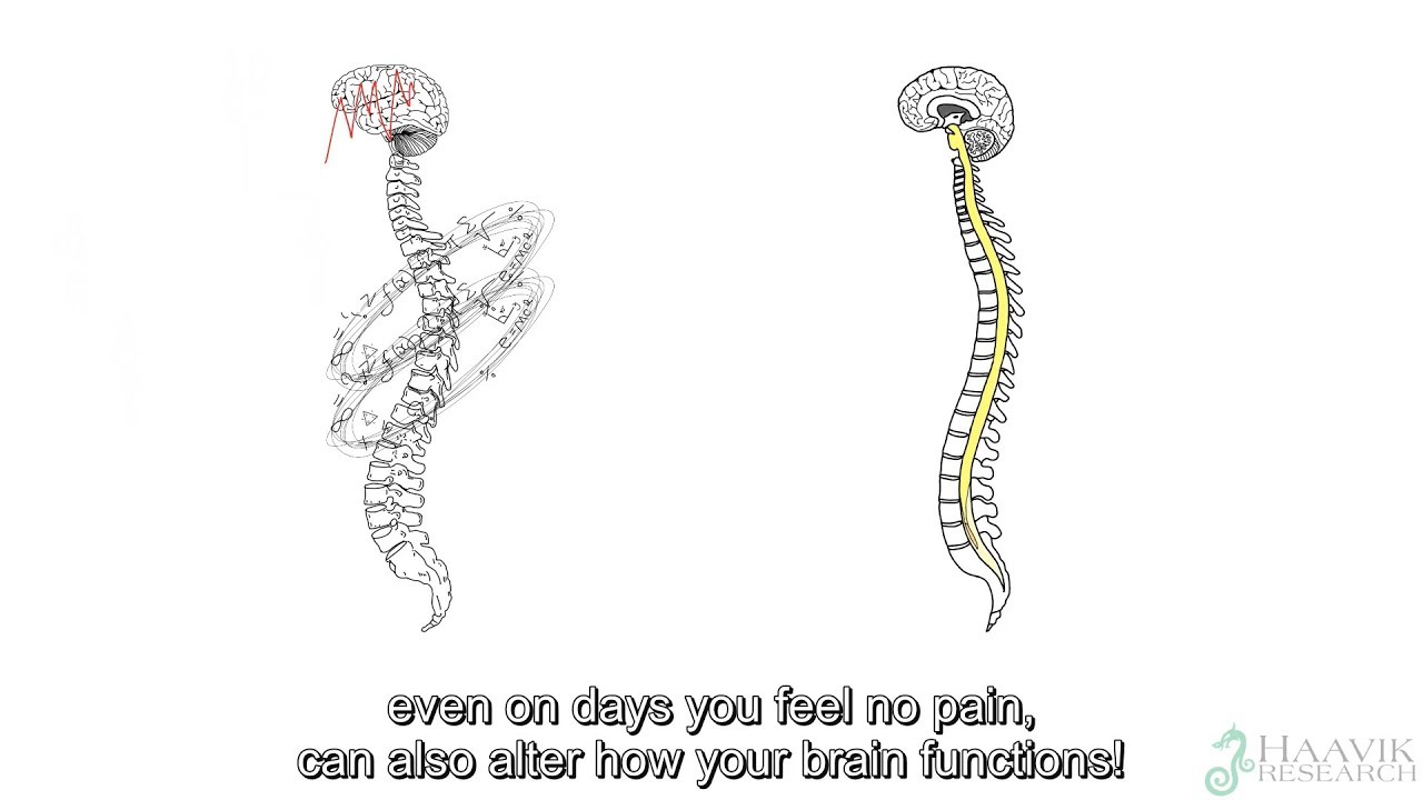 How Spinal Dysfunction Affects the Brain - YouTube