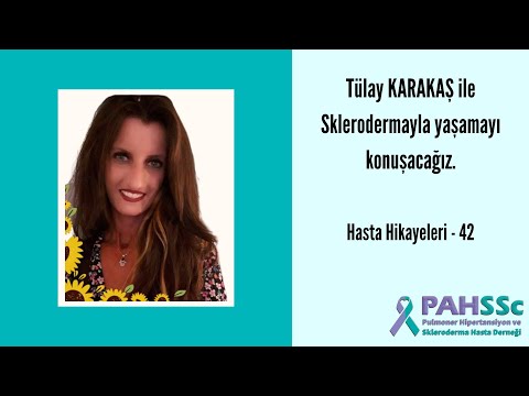 Hasta Hikayeleri - Tülay KARAKAŞ ile Sklerodermayla Yaşamak - 42