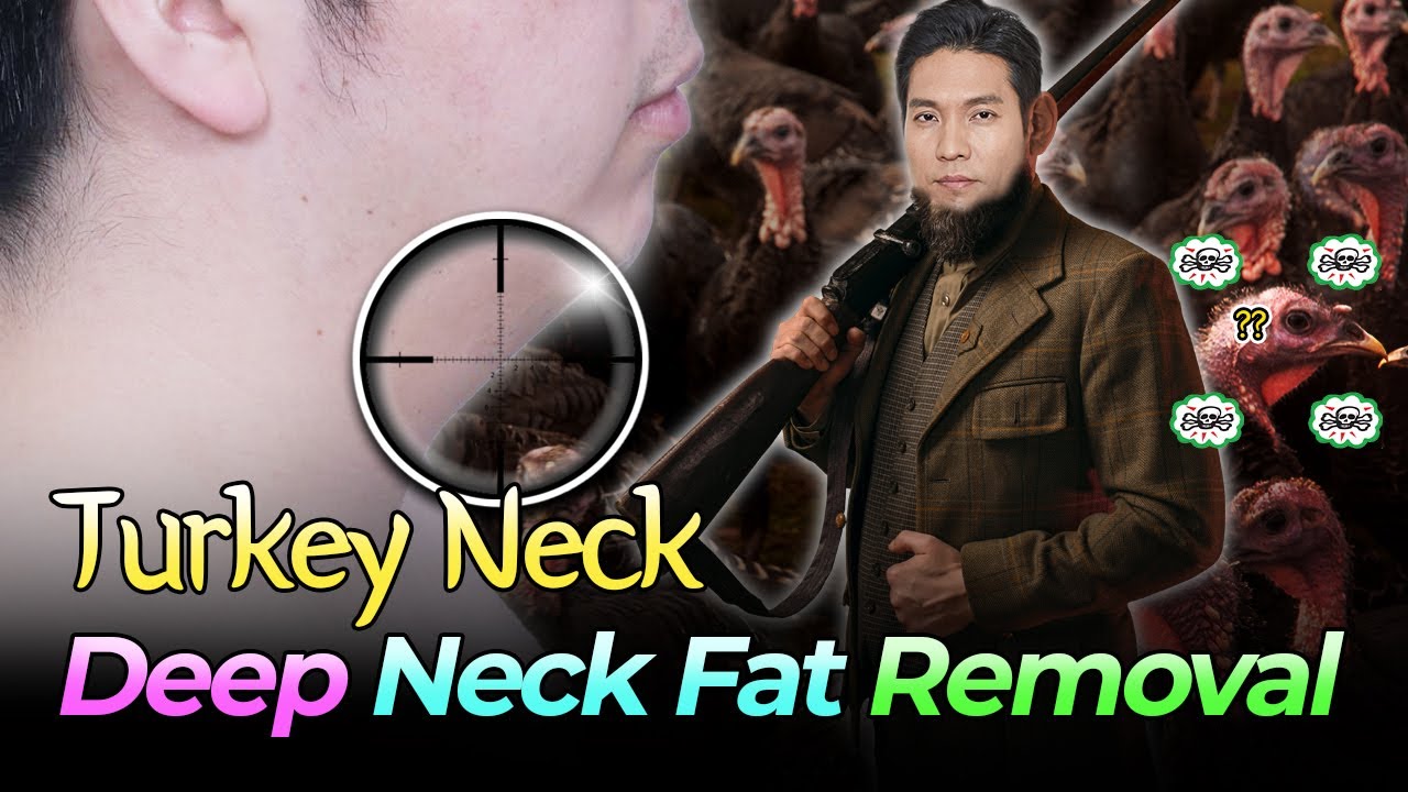 Turkey Neck Solution with MINE Plastic Surgery - YouTube