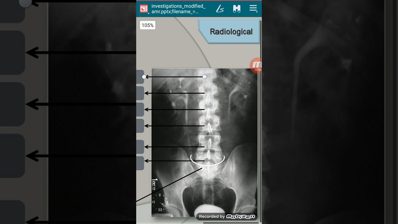 Uro-Radiology 1 - YouTube