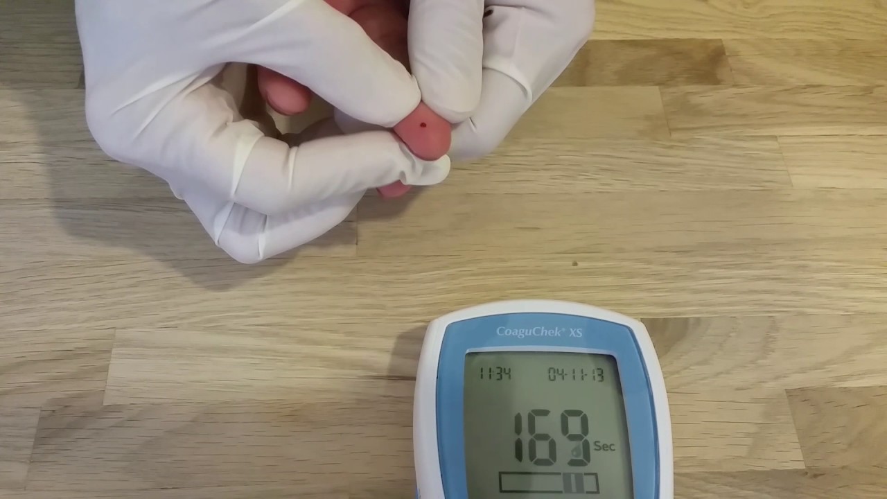 Het prikken van een INR - YouTube