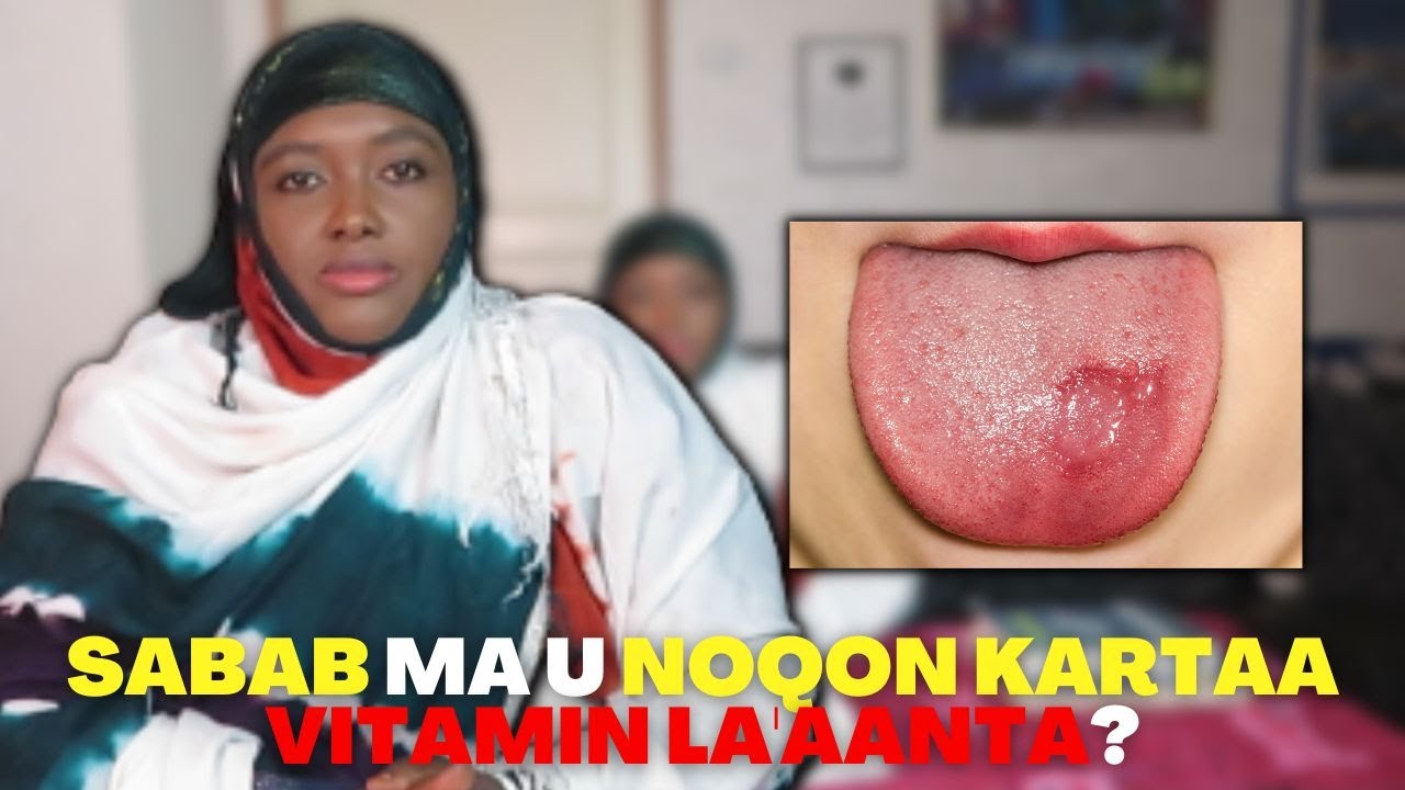 XANUUNKA CARABKA KUDHACA SABAB MA U NOQON KARA, HADDII FEYTAMIINADA IYO ...